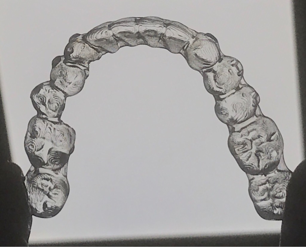 PROBLEMS - 贝致——专业口腔服务平台，让你变美的牙套交流社区